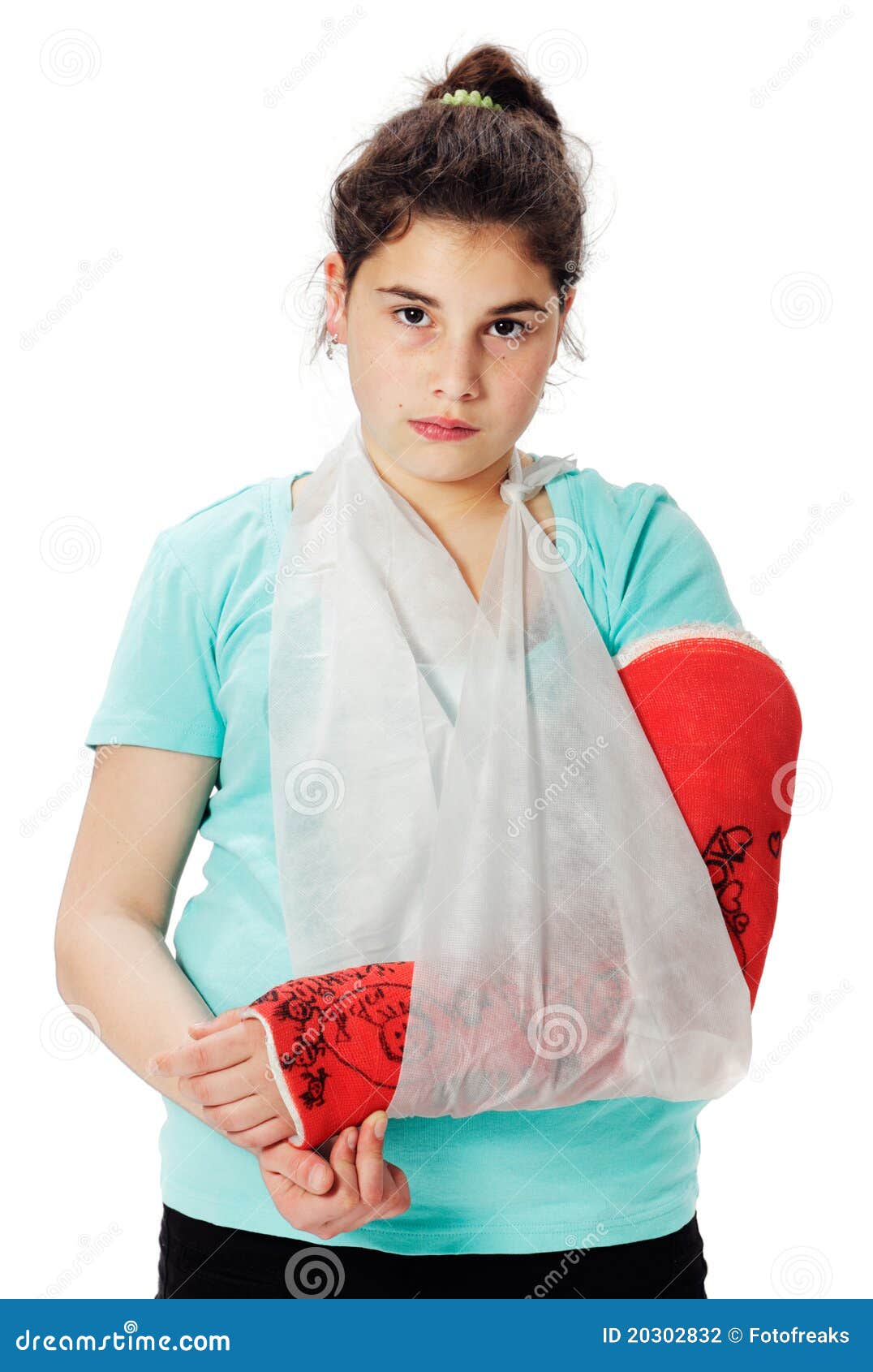 Sad girl with plaster cast stock photo. Image of expression - 20302832