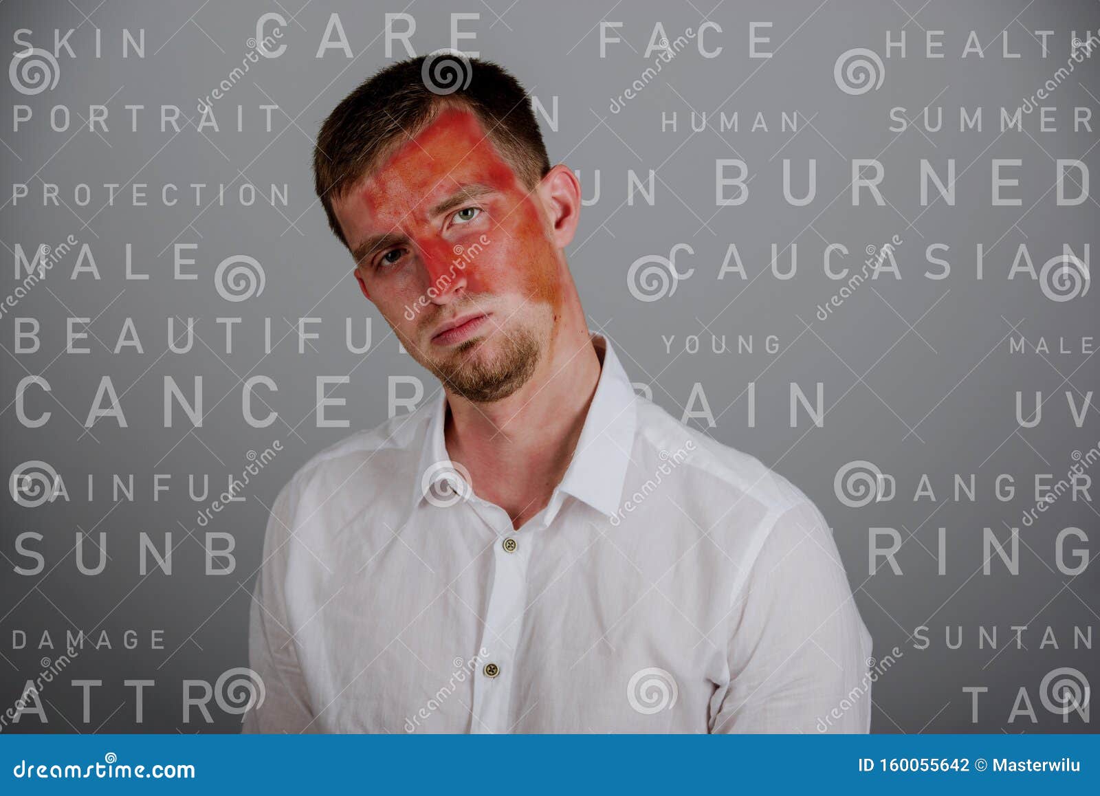 Worried Sunburned Man With Skin Irritation Stock Image Cartoondealer
