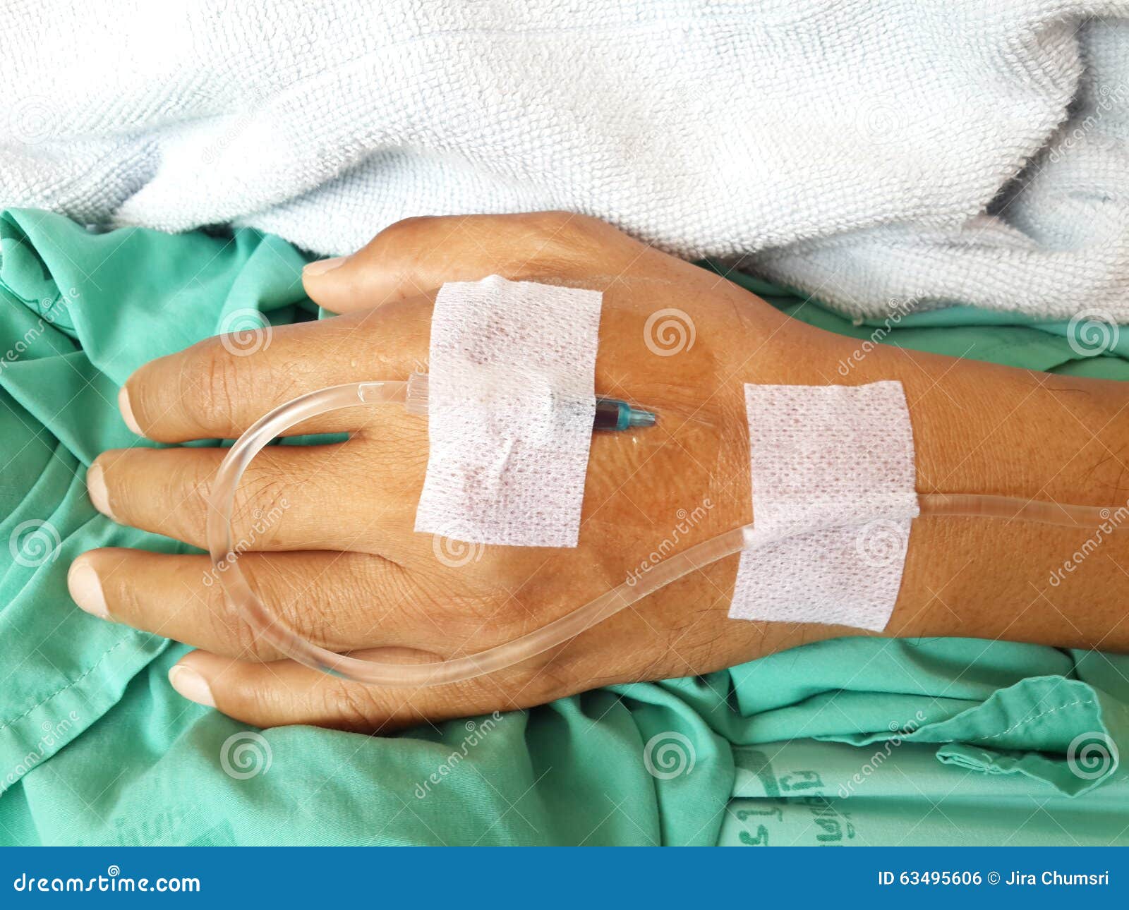 Injecting Saline Into Your Sac