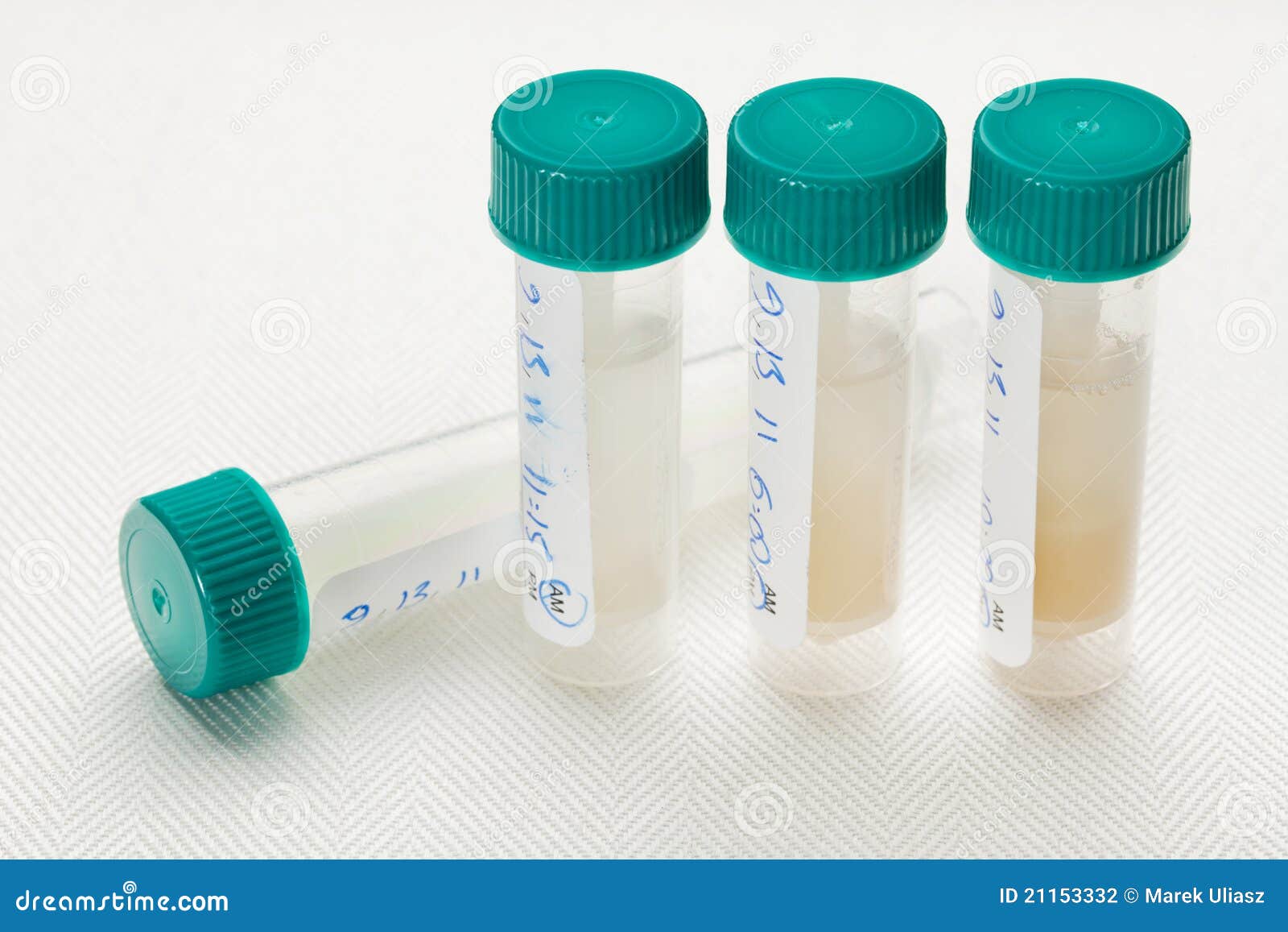 Saliva Samples for Laboratory Test Stock Photo - Image of label ... Saliva Samples for Laboratory Test Stock Photo - Image of label ...
