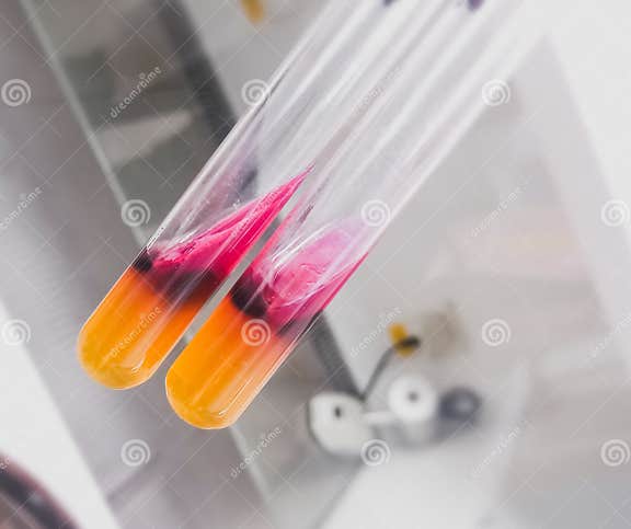 Salmonella Detection Method by Using Triple Sugar Iron (TSI) Agar in ...