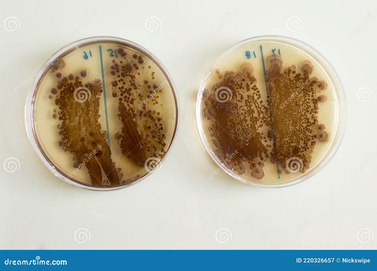Salmonella Colony Growth On Selective Media Plate. Food Safety Test ...