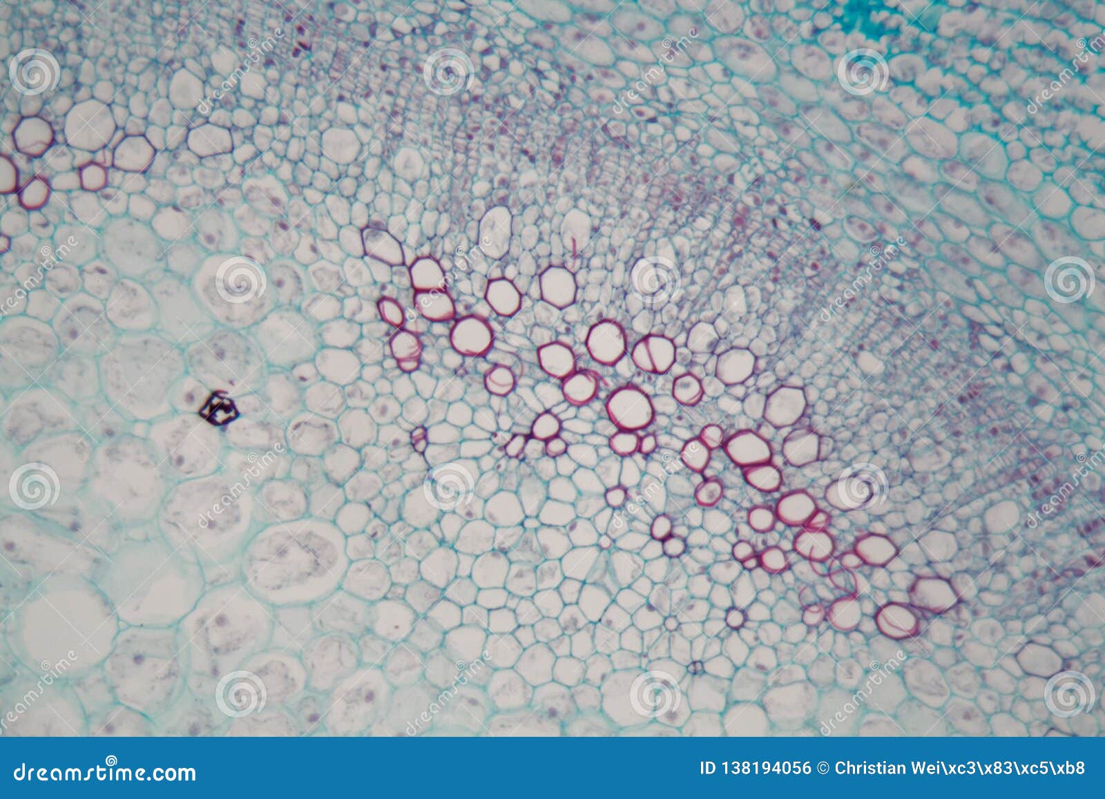 Sambucus Stem with Parenchyma Cells Under the Microscope Stock Photo ...