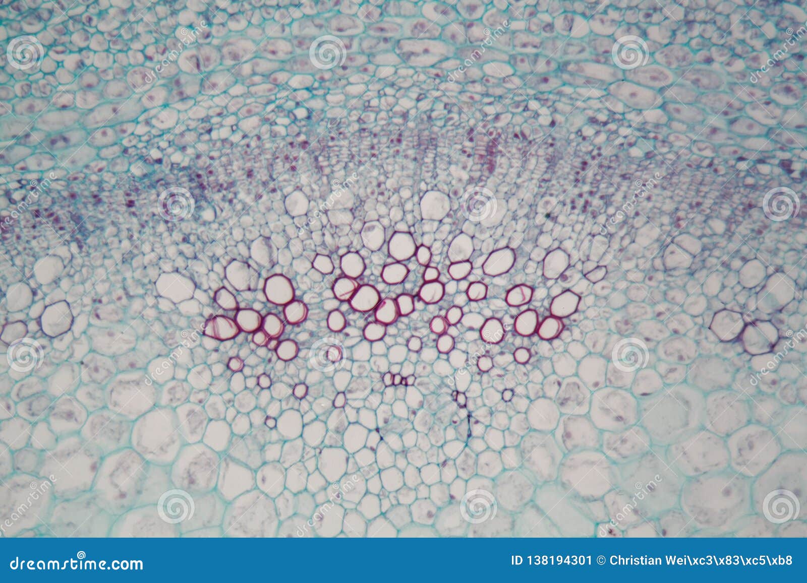 Sambucus Stem with Parenchyma Cells Under the Microscope Stock Image ...