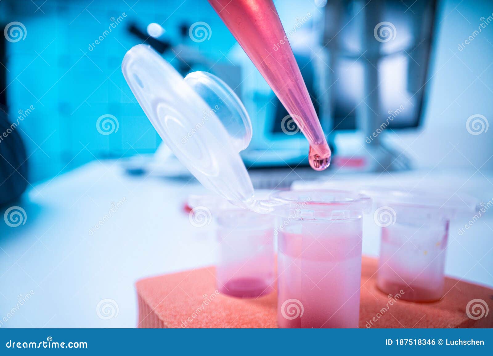 Sample of Biological Sample for DNA Analysis Stock Photo - Image of ...