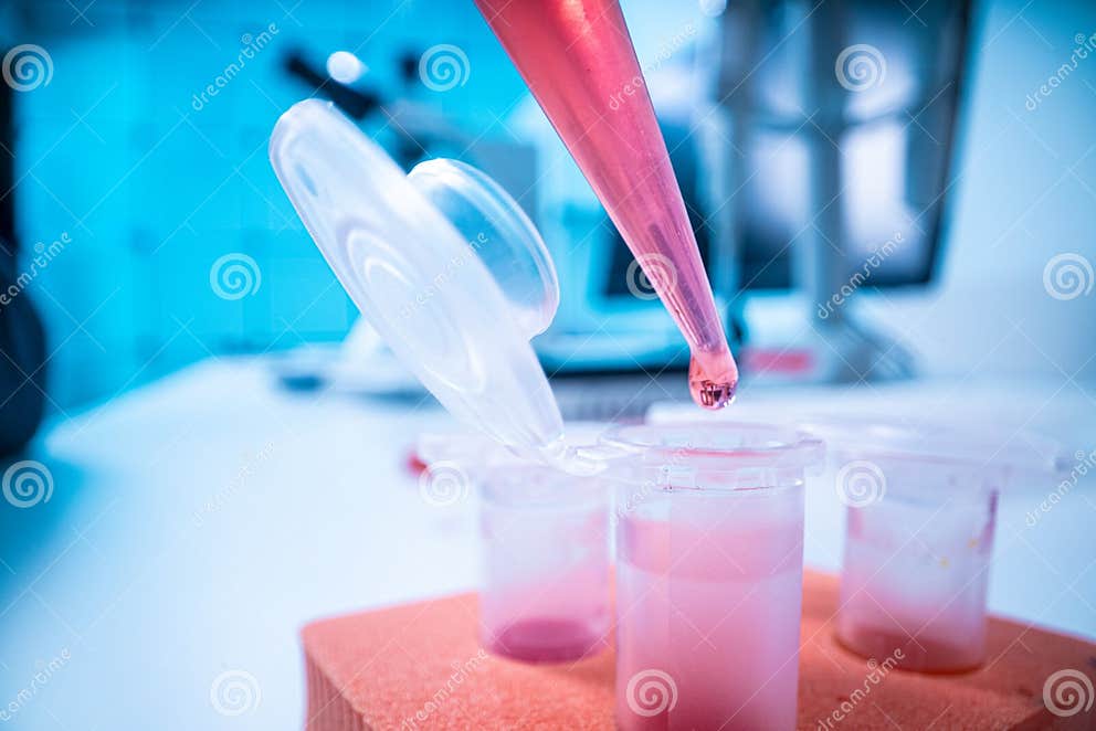 Sample of Biological Sample for DNA Analysis Stock Photo - Image of ...