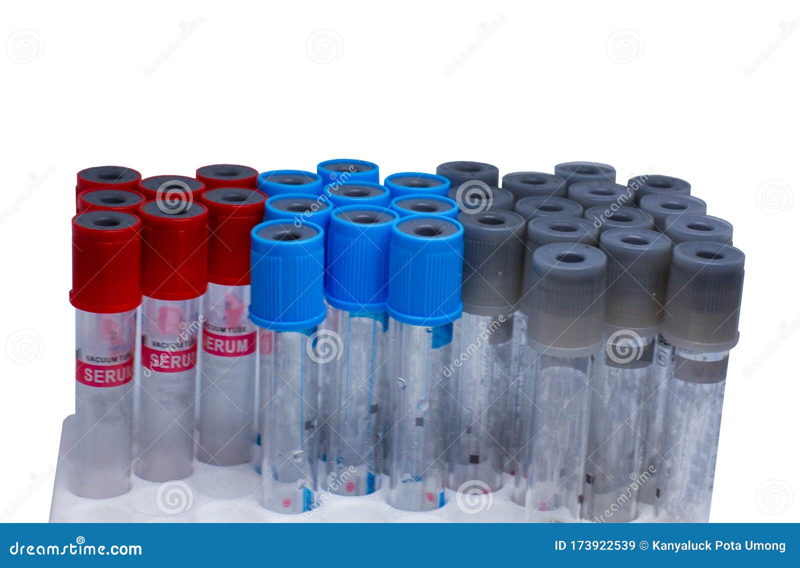 Sample Blood Collection Tube With HIV Test Label. Royalty-Free Stock ...