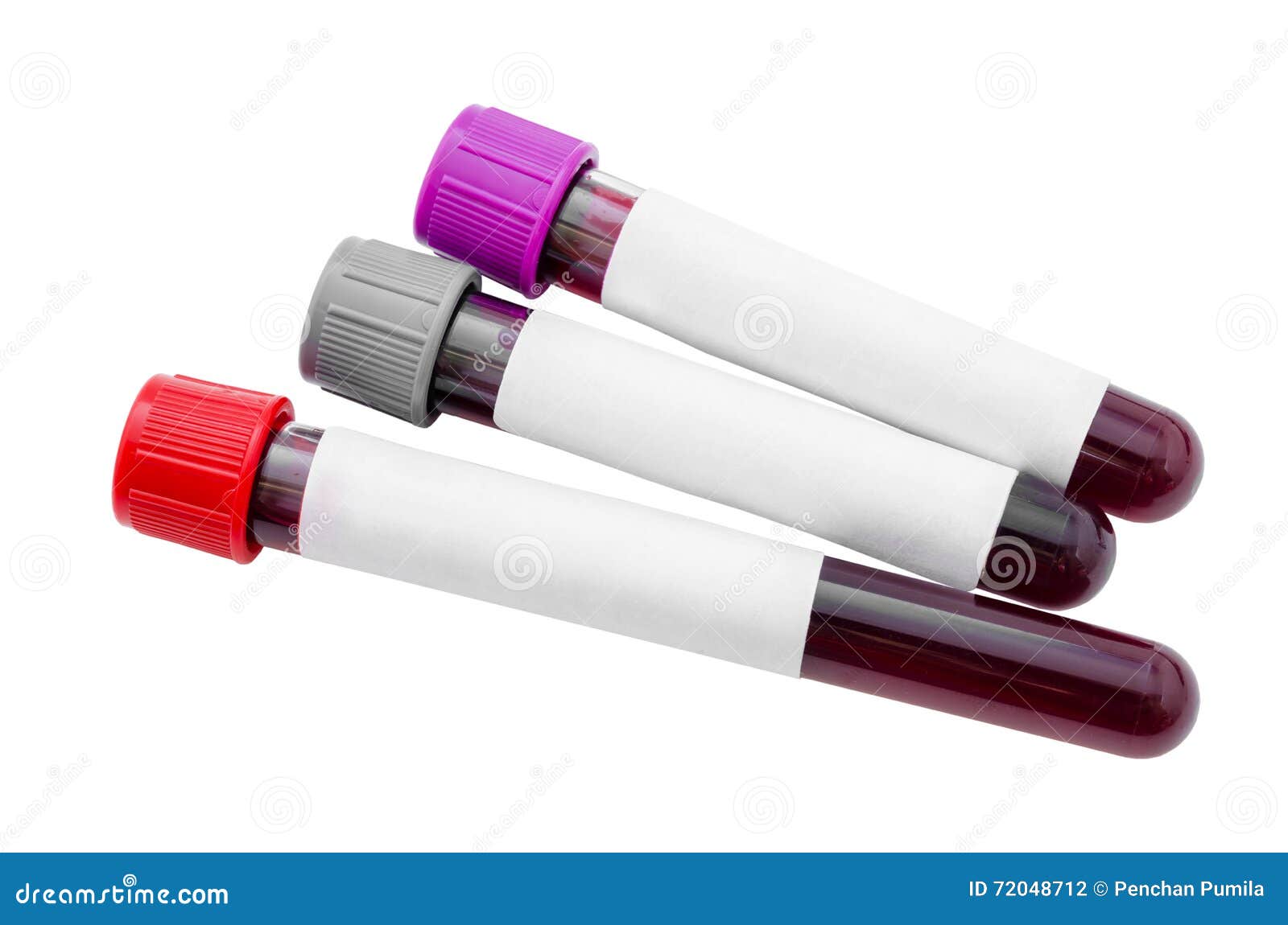Blood Sample In Test Tubes Stock Photography | CartoonDealer.com #36604448