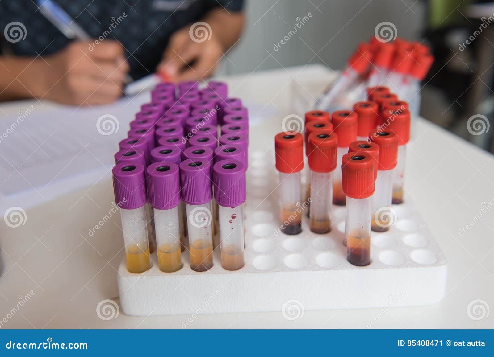 Sample Blood Tube from Patient in Laboratory . Stock Image - Image of ...