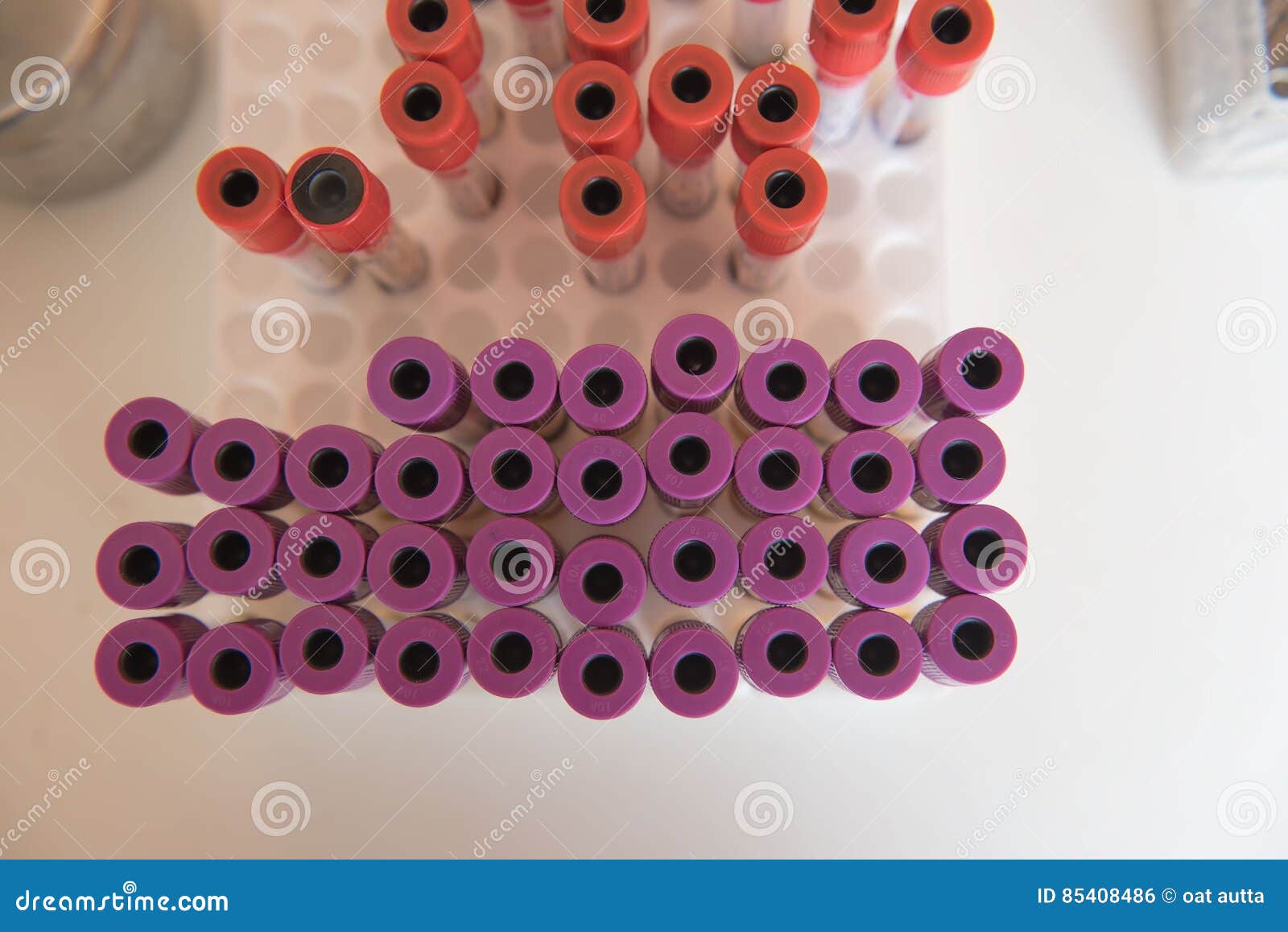 Sample Blood Tube from Patient in Laboratory . Stock Photo - Image of ...