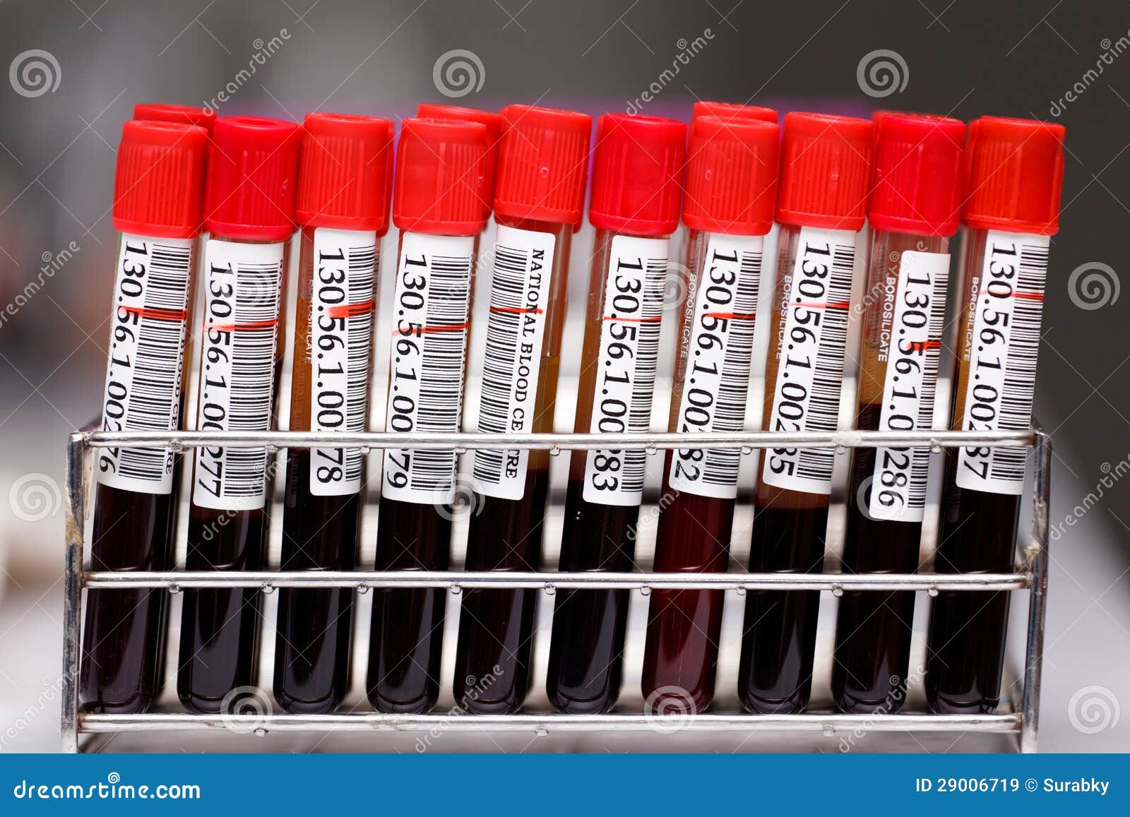 Sample Blood Tubes in Labï¿½ratory Stock Image - Image of laboratory ...