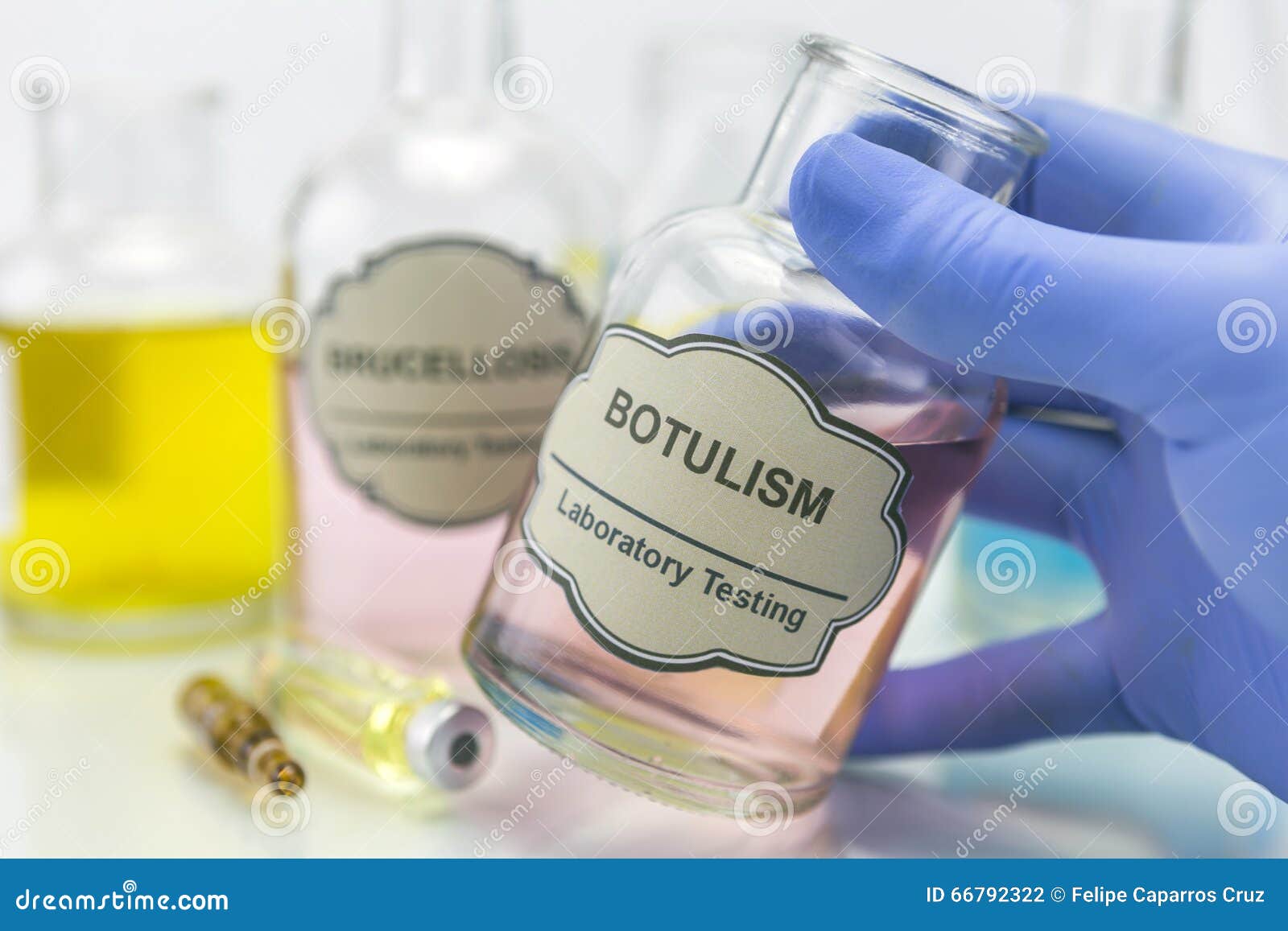 Sample of Cholera in Laboratory Stock Photo - Image of analysis ...