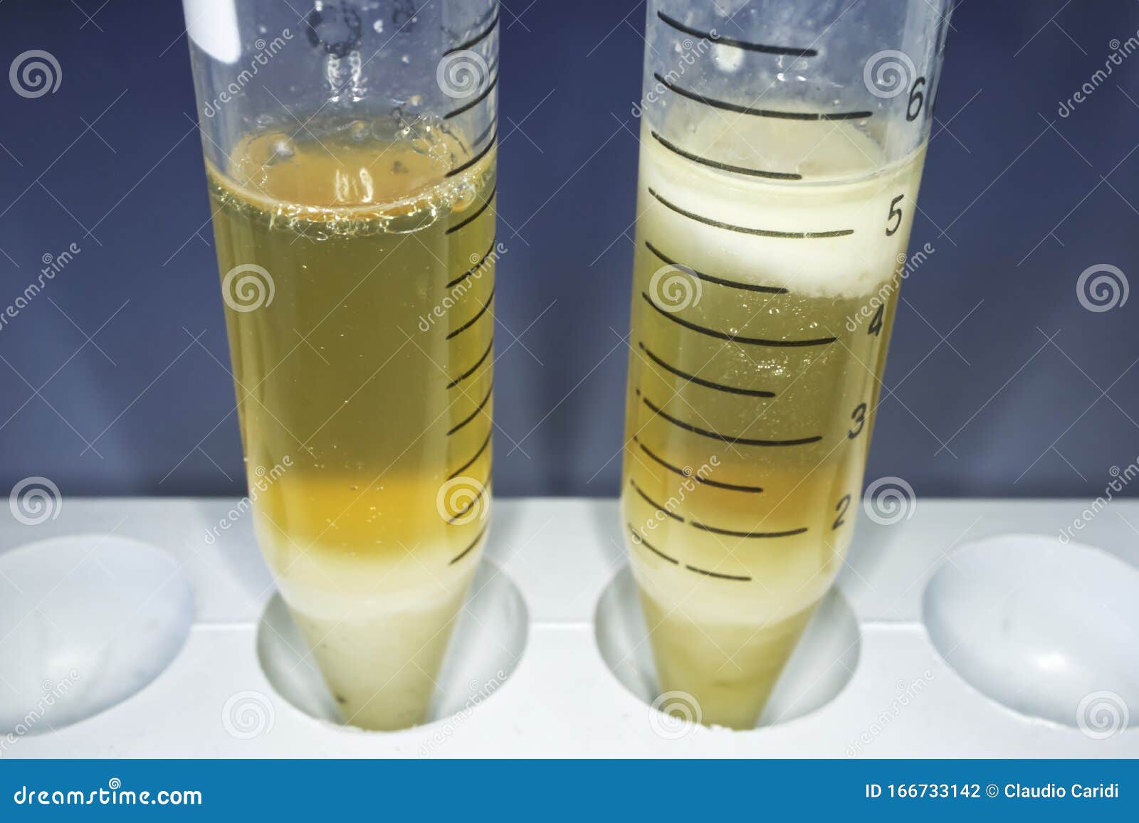 Sample Food Lysate for DNA Extraction in a 15 Ml Tube. Stock Photo ...
