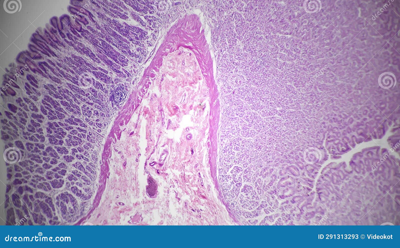 Sample of Human Stomach in Section Studied in Lab Under Microscope 100x ...