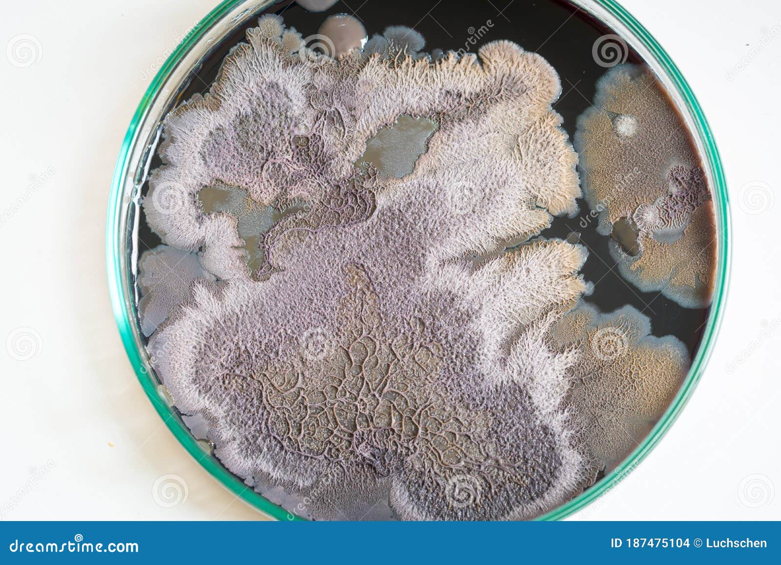 Sample of Pathology Microorganisms Colony in Petri Dish Stock Photo ...