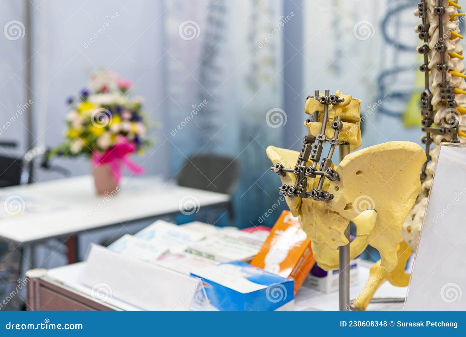 Sample Structure Show Hip Bone and Spine Bone with Metal Fixation Set ...