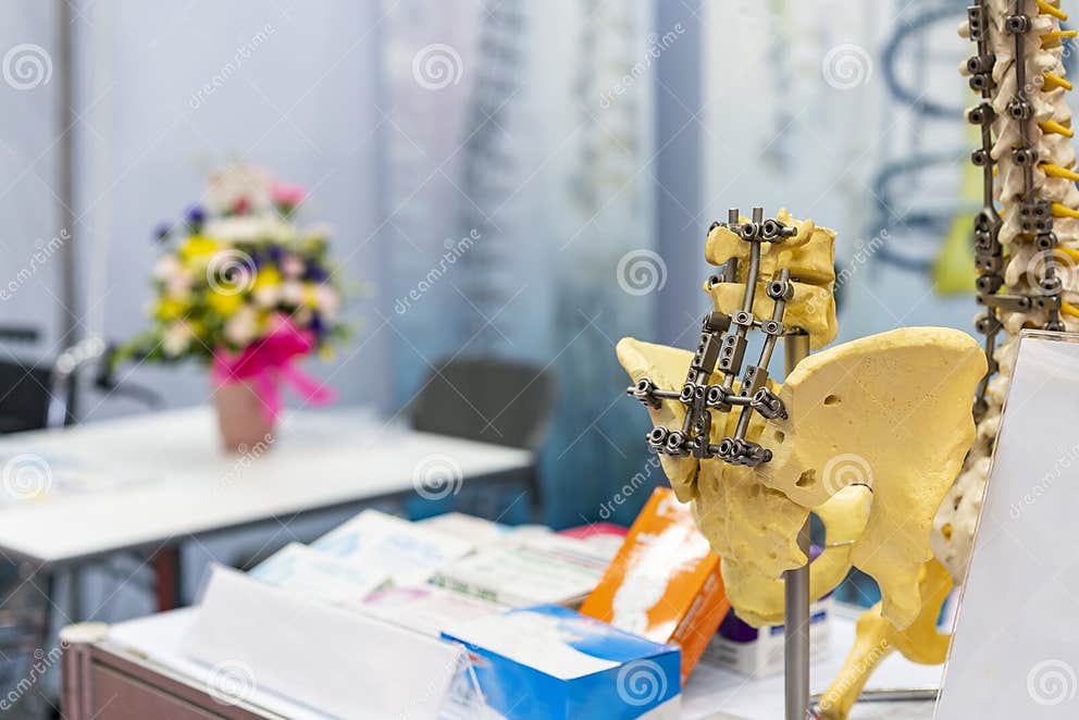 Sample Structure Show Hip Bone and Spine Bone with Metal Fixation Set ...