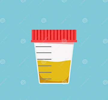 Sample of Urine Test Vector Illustration. Containers for Analysis Stock ...