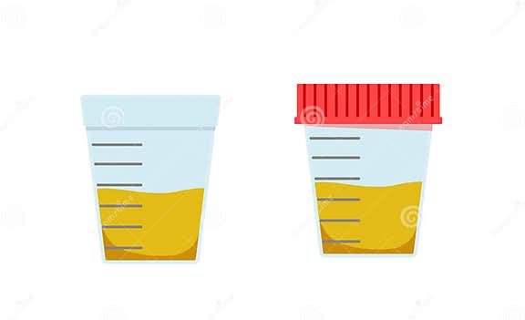 Sample of Urine Test Vector Illustration. Containers for Analysis Stock ...