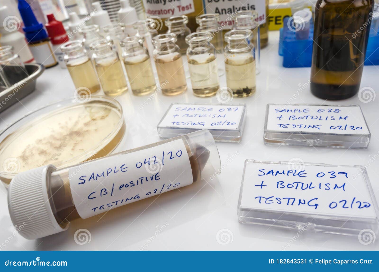 Samples Contaminated by Clostridium Botulinum Toxin that Causes ...
