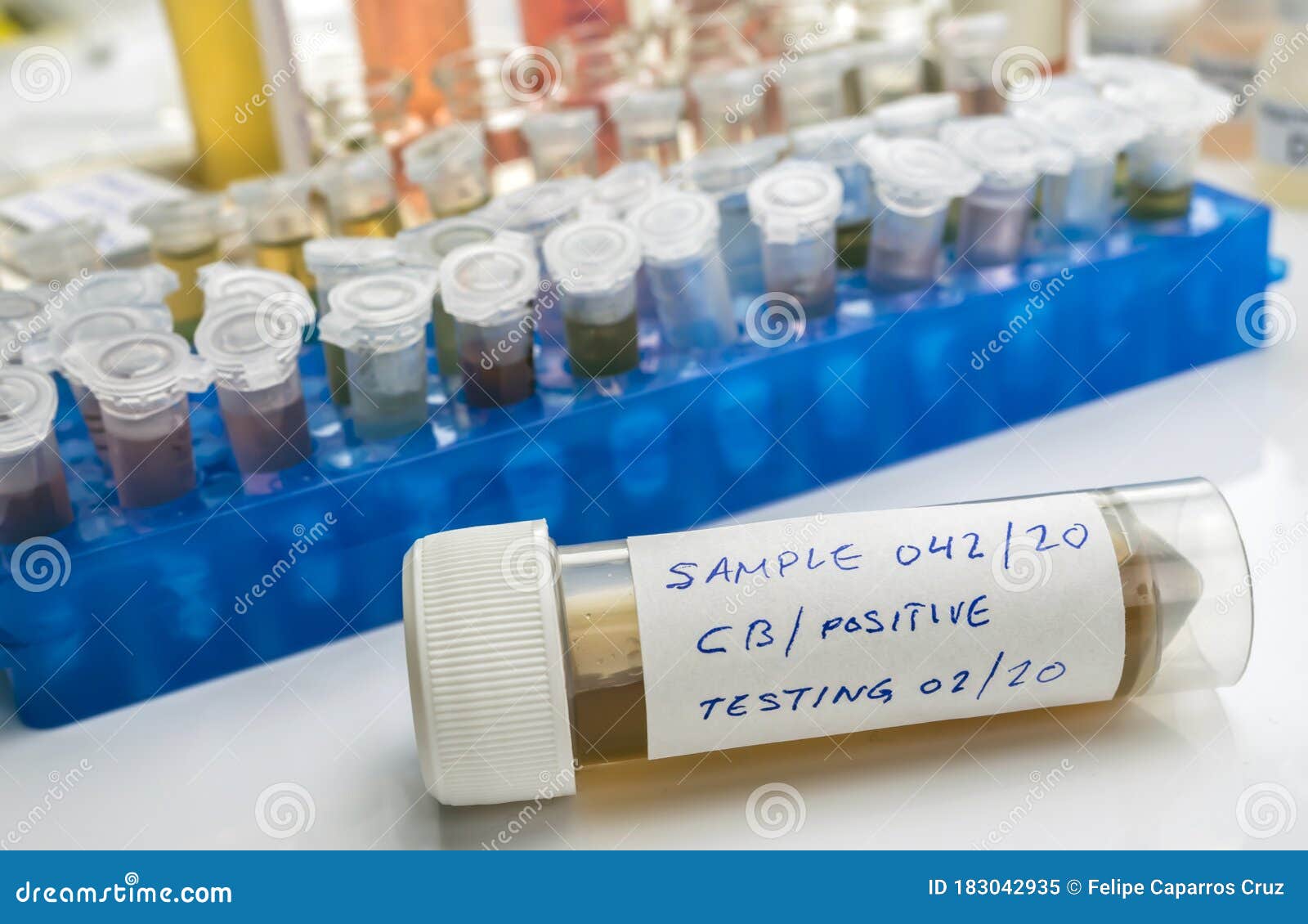 Samples Contaminated By Clostridium Botulinum Toxin That Causes ...