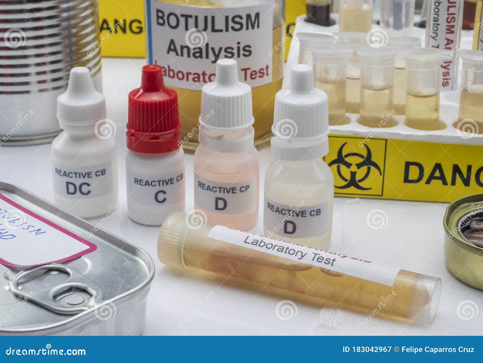 Samples Contaminated by Clostridium Botulinum Toxin that Causes ...