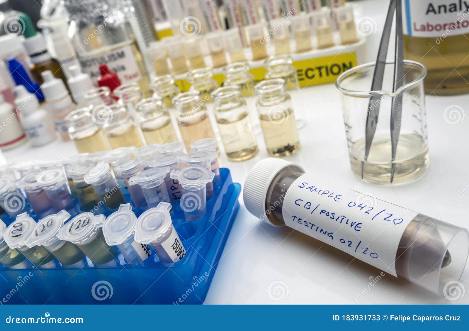 Samples Contaminated By Clostridium Botulinum Toxin That Causes ...