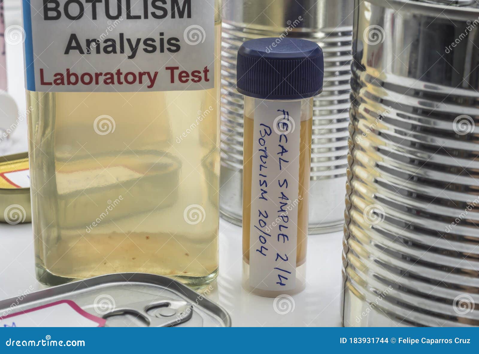 Samples Contaminated by Clostridium Botulinum Toxin that Causes ...