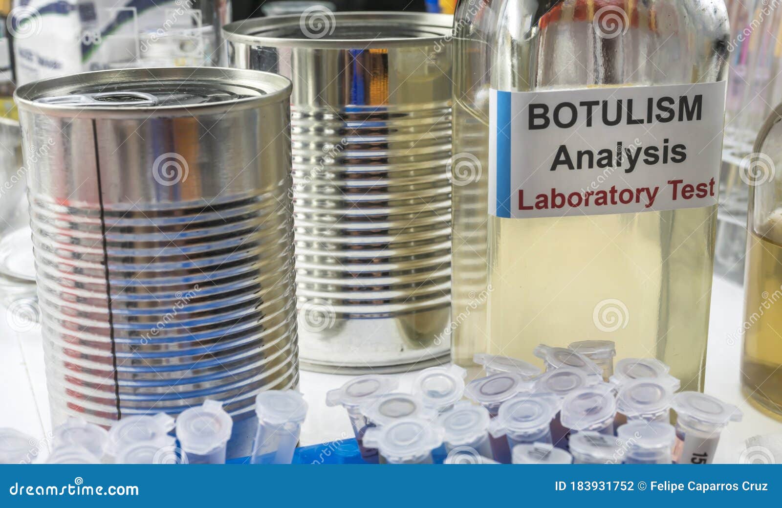 Samples Contaminated by Clostridium Botulinum Toxin that Causes ...