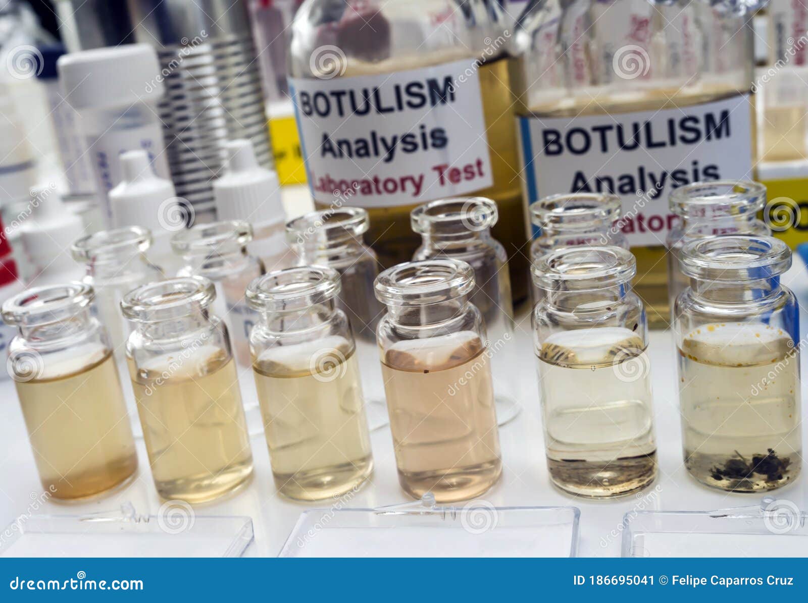 Samples Contaminated by Clostridium Botulinum Toxin that Causes ...