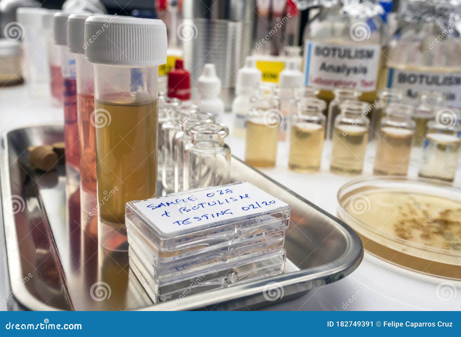 Samples Contaminated by Clostridium Botulinum Toxin that Causes ...