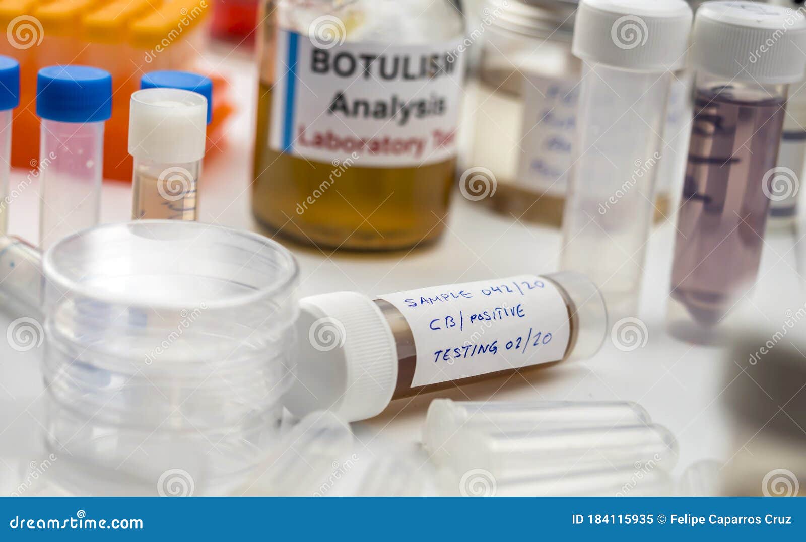 Samples Contaminated by Clostridium Botulinum Toxin that Causes ...