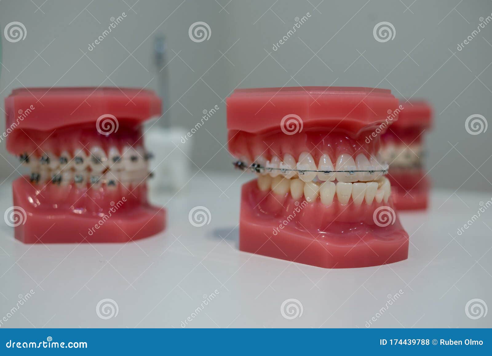 Samples of Dentures with Porcelain Teeth and Dental Device on a White ...