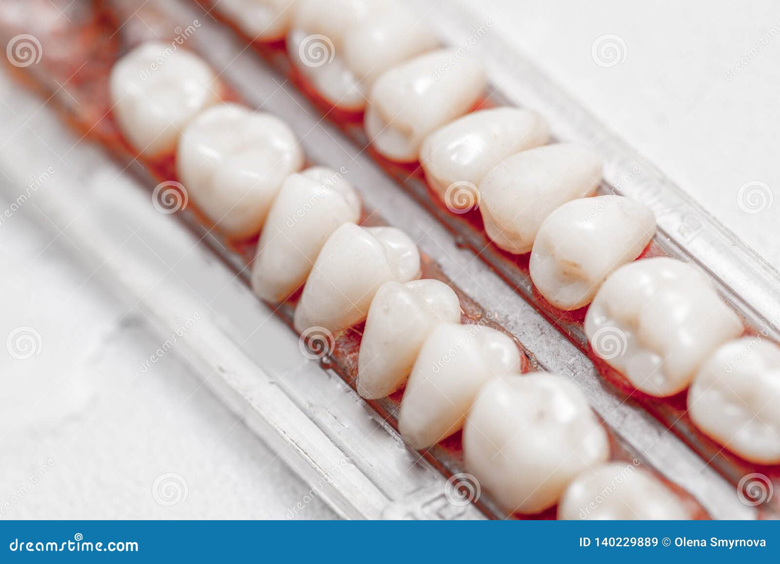 Samples of human teeth stock image. Image of implant - 140229889