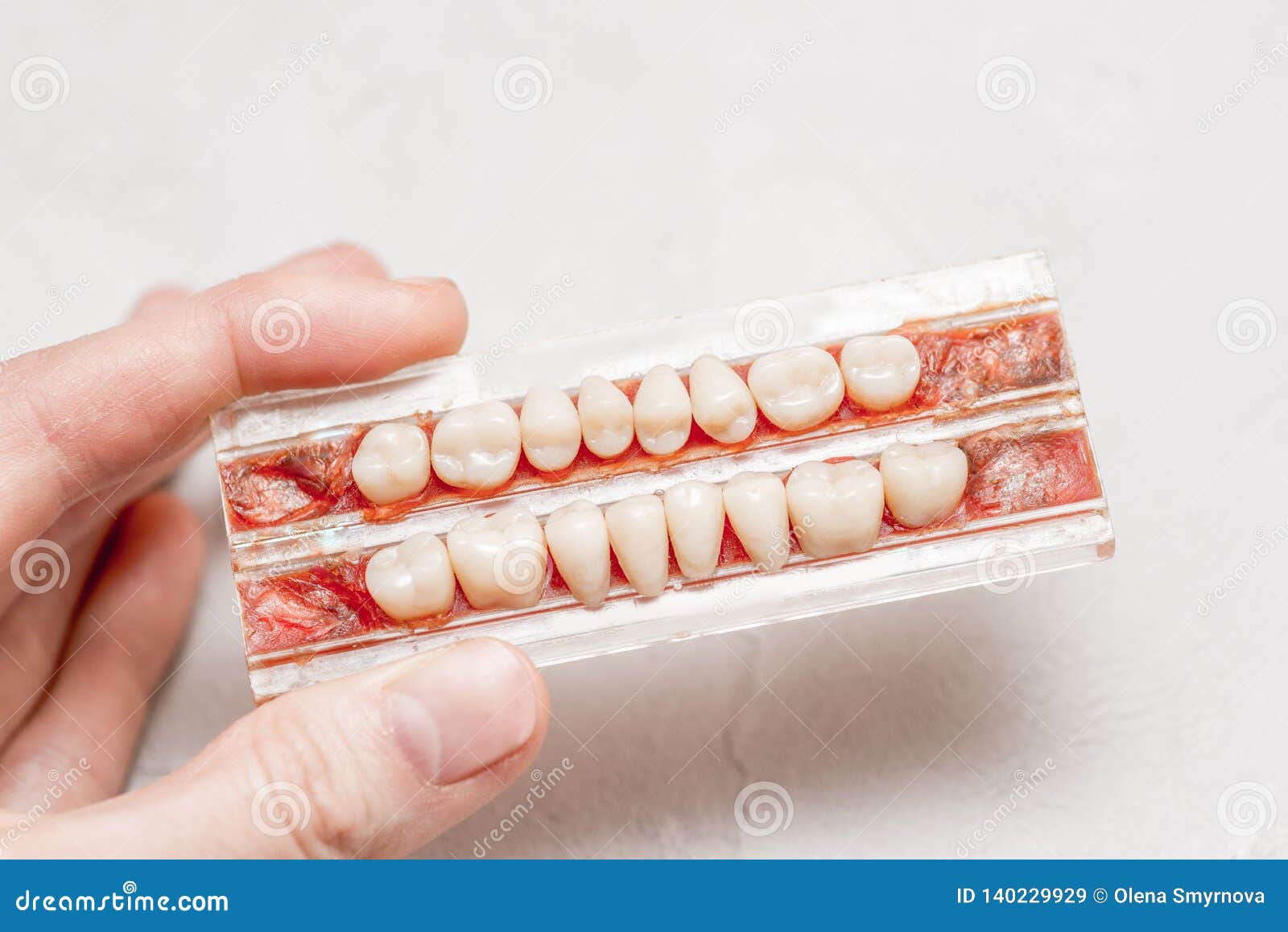 Samples of human teeth stock image. Image of person - 140229929