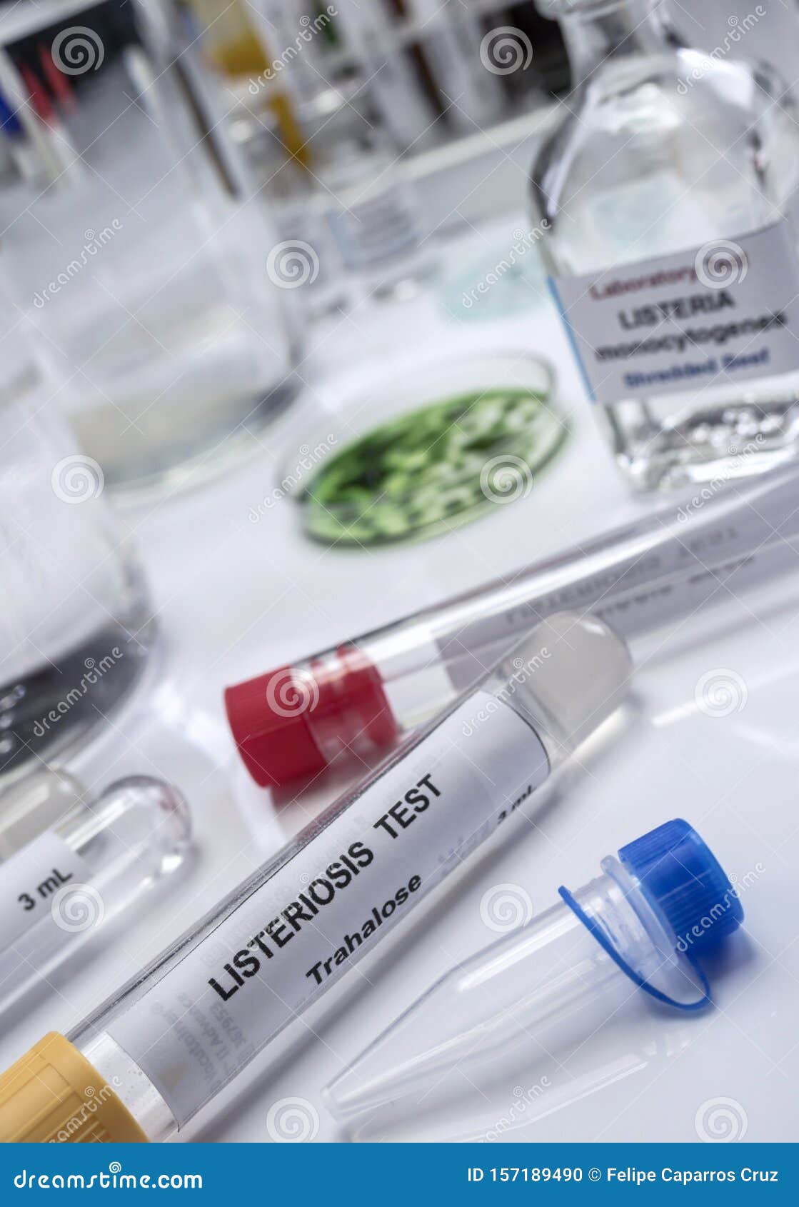 Samples You Analyze of Stuffed Meat Contaminated by Bacterium of ...