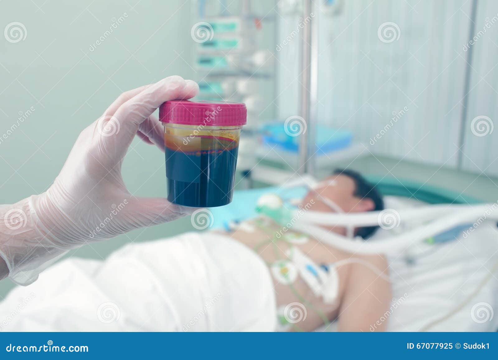 Sampling Patient in Critical Condition Stock Image - Image of emergency ...