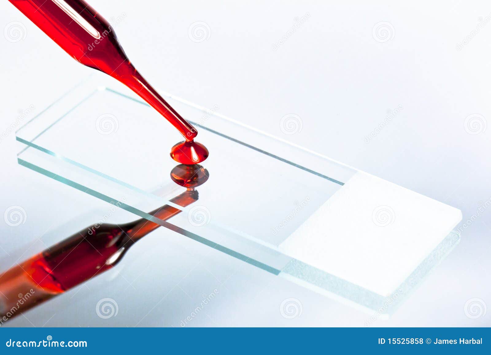 Sang Relâché Sur Diapositive 1 De Microscope Photo stock - Image du ...