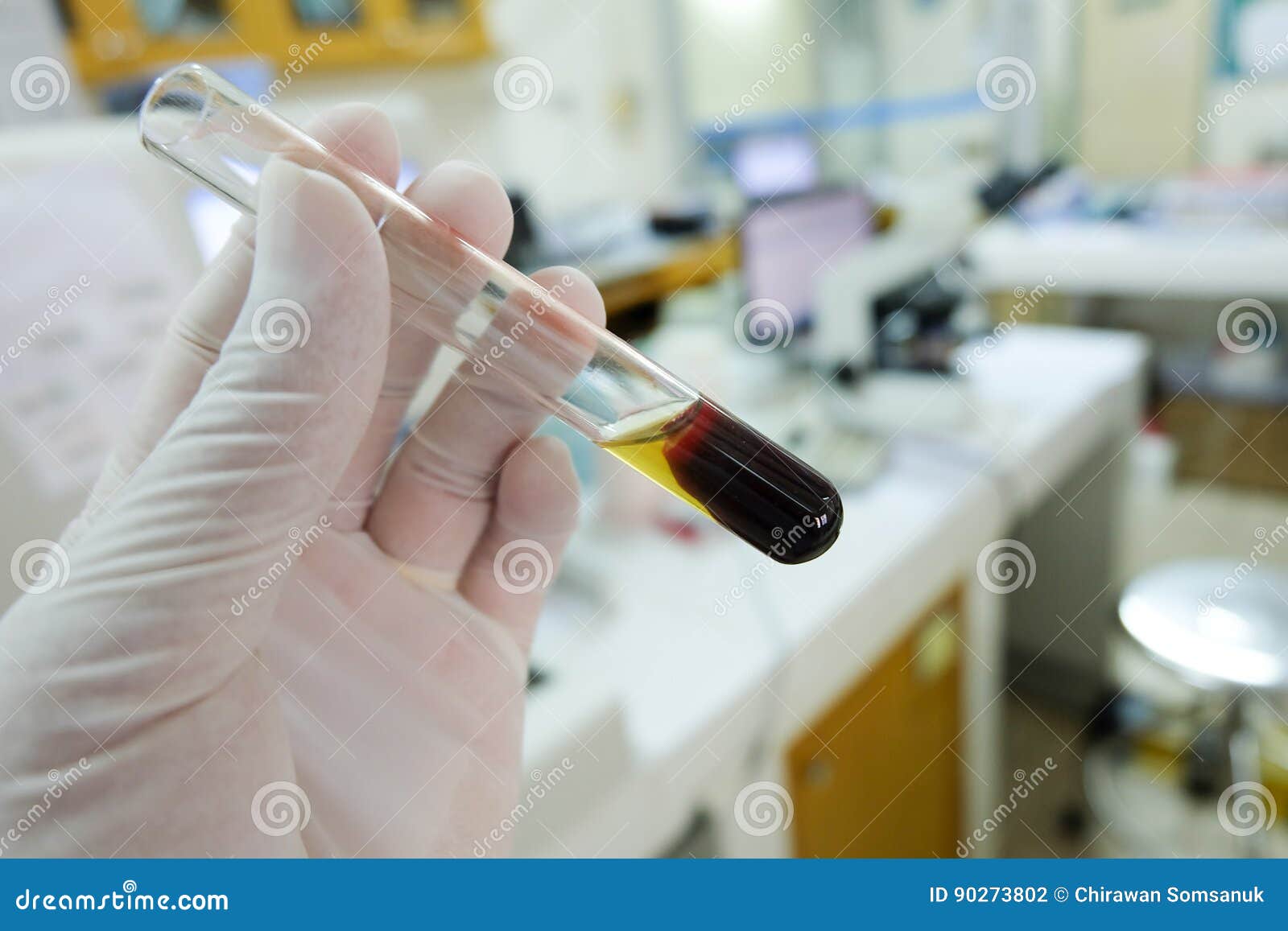 Sangue coagulado foto de stock. Imagem de coagulado, experiência - 90273802