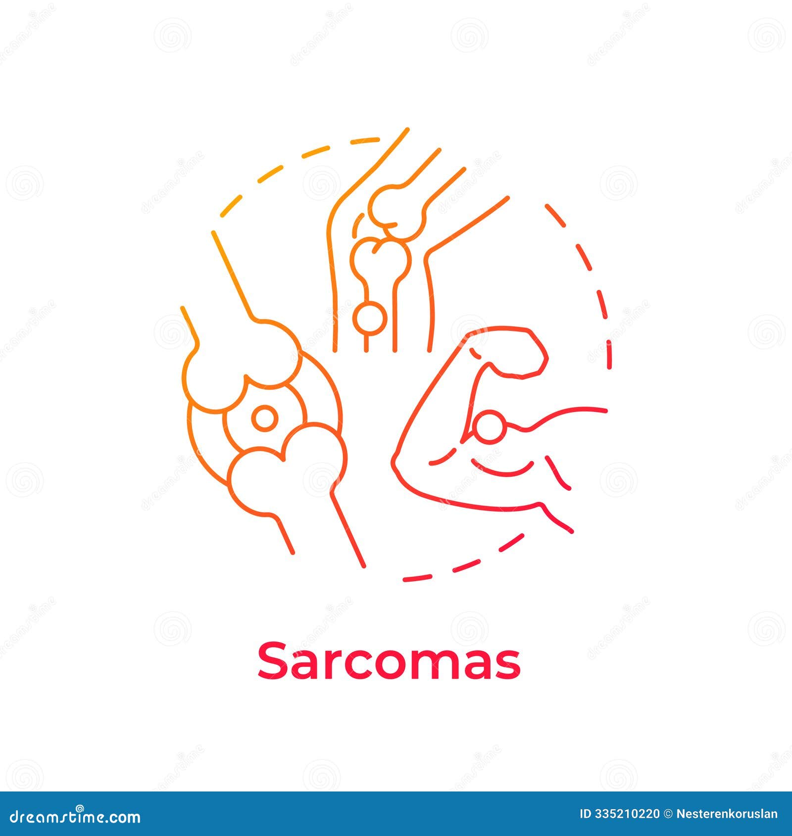 Osteosarcoma Cartoons, Illustrations & Vector Stock Images - 280 ...