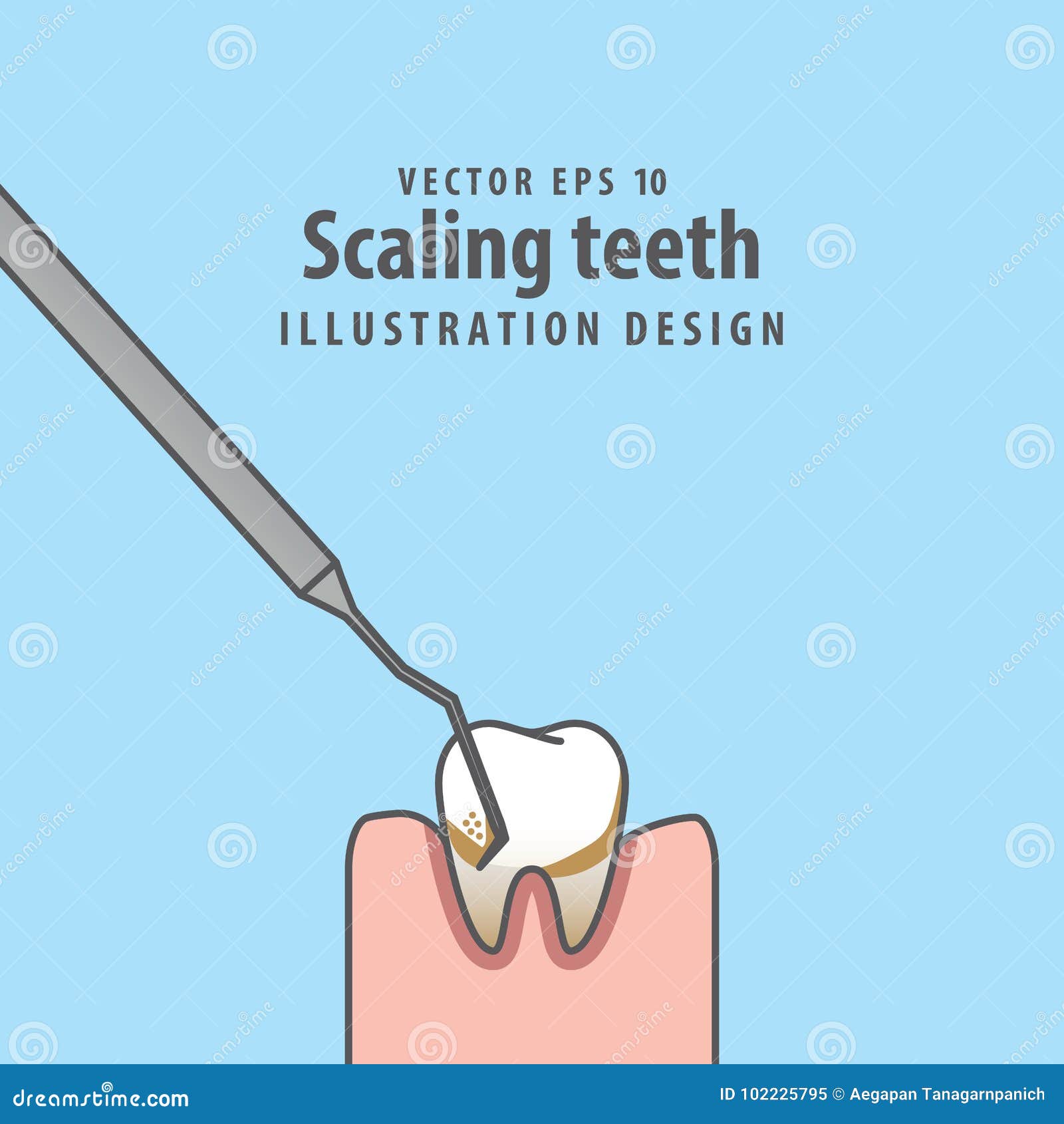Scaling Teeth Illustration Vector on Blue Background. Dental Con Stock ...