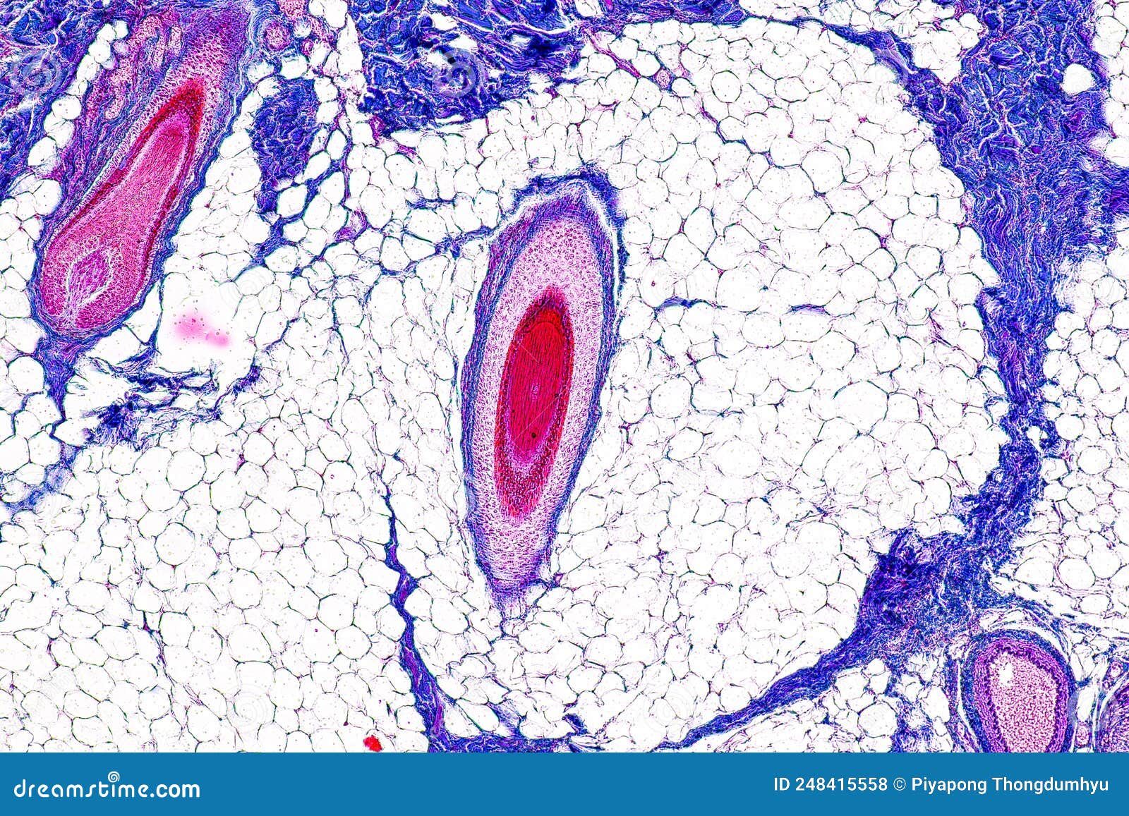 Scalp and Hair Follicles of Human Under the Microscope. Stock Photo ...