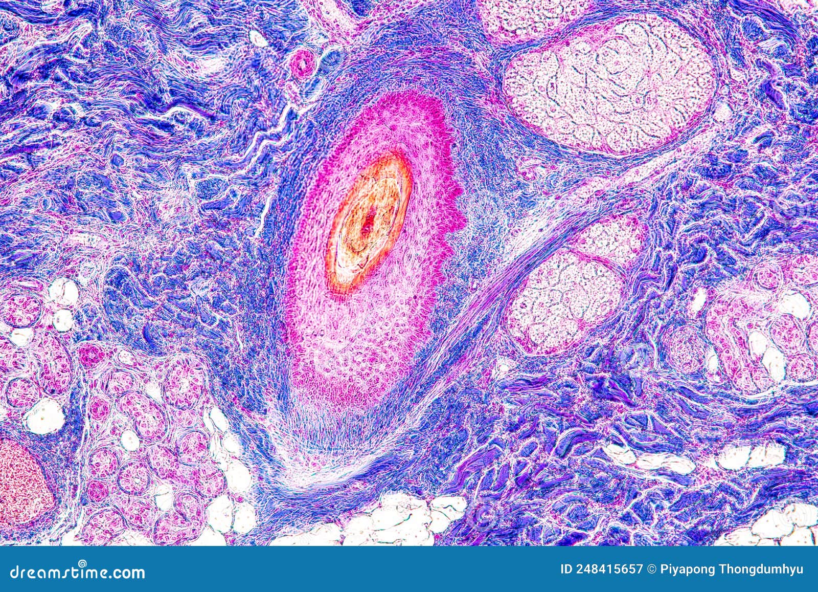 Scalp and Hair Follicles of Human Under the Microscope. Stock Image ...