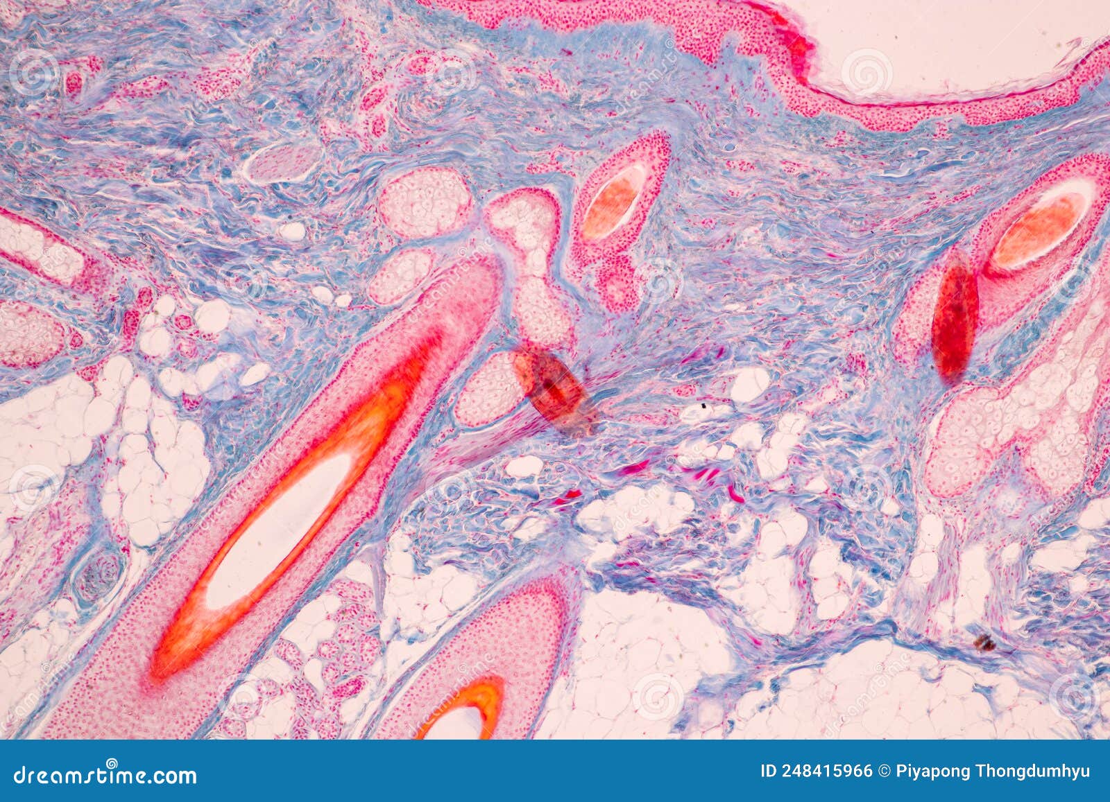 Scalp and Hair Follicles of Human Under the Microscope. Stock Photo ...