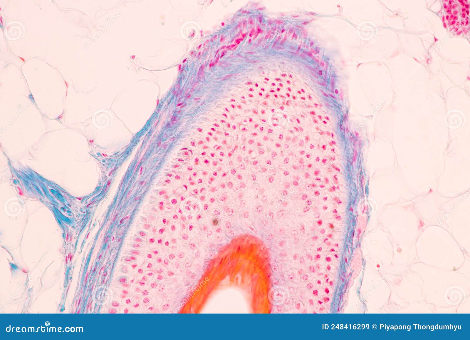 Scalp and Hair Follicles of Human Under the Microscope. Stock Image ...
