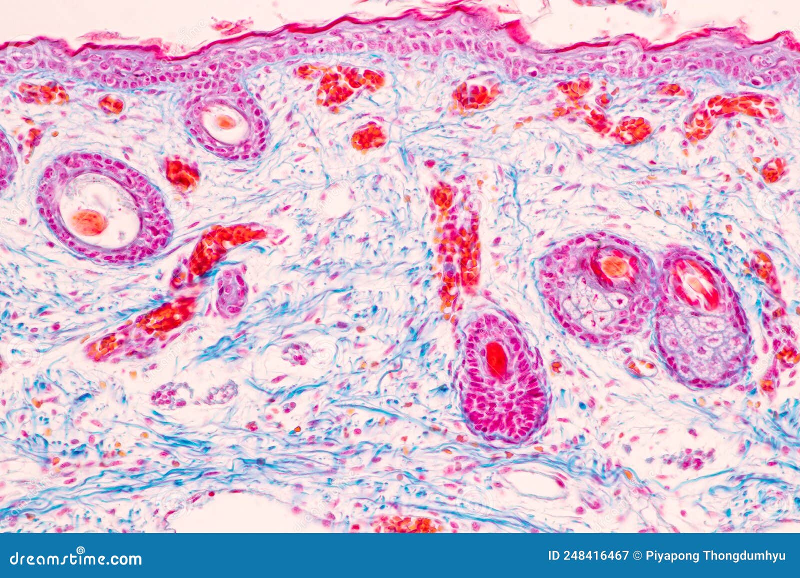 Scalp and Hair Follicles of Human Under the Microscope. Stock Image ...