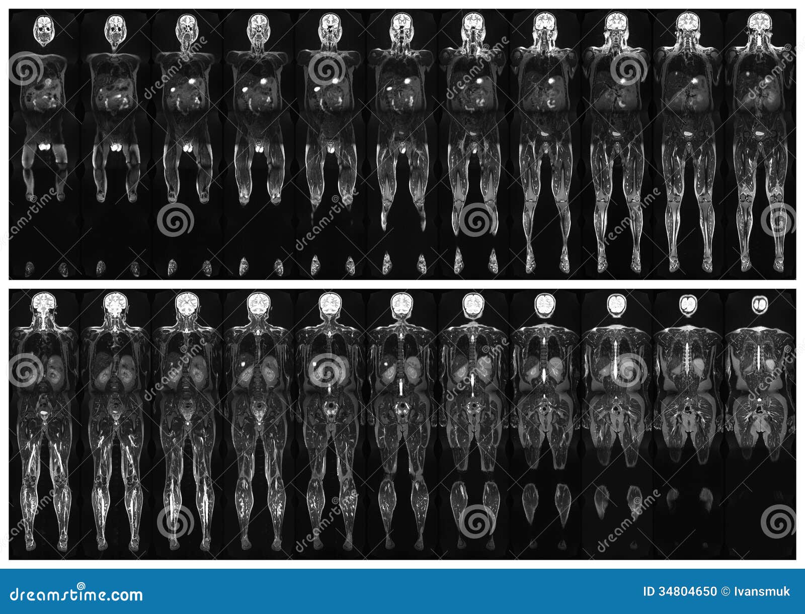 Scan the human body stock photo. Image of illness, lumbar - 34804650