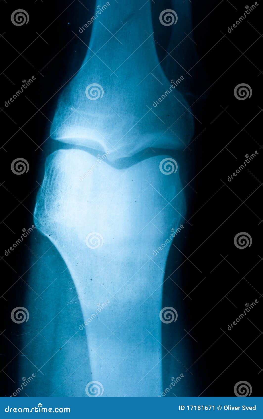 A scan of the human leg stock image. Image of examination - 17181671