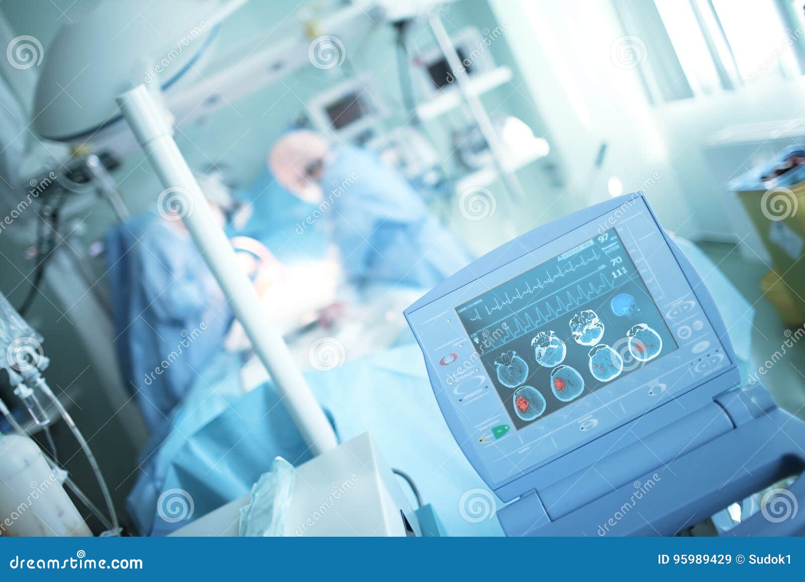 Scanning of Brain Damage in the ICU Stock Image - Image of bloodstroke ...
