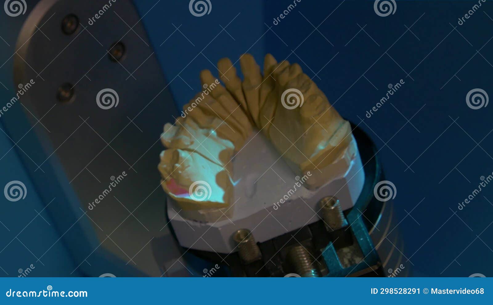 Scanning of Casts on a 3D Scanner for the Manufacture of Dentures ...